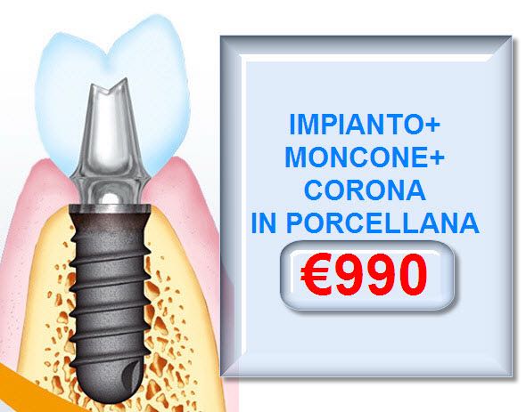 IMPIANTO MONCONE CORONA IN PORCELLANA - Centro Odontoiatrico Piccolo Napoli